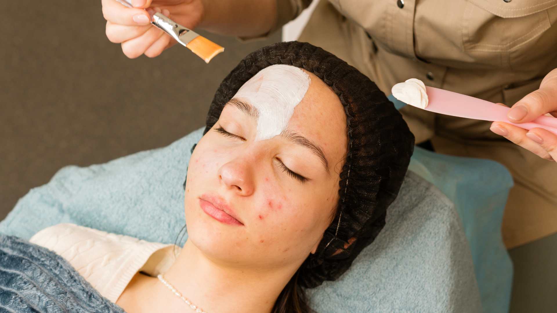 Clear Ocean: Acne Treatment Excellence by Athens Skin Doctors at M ...