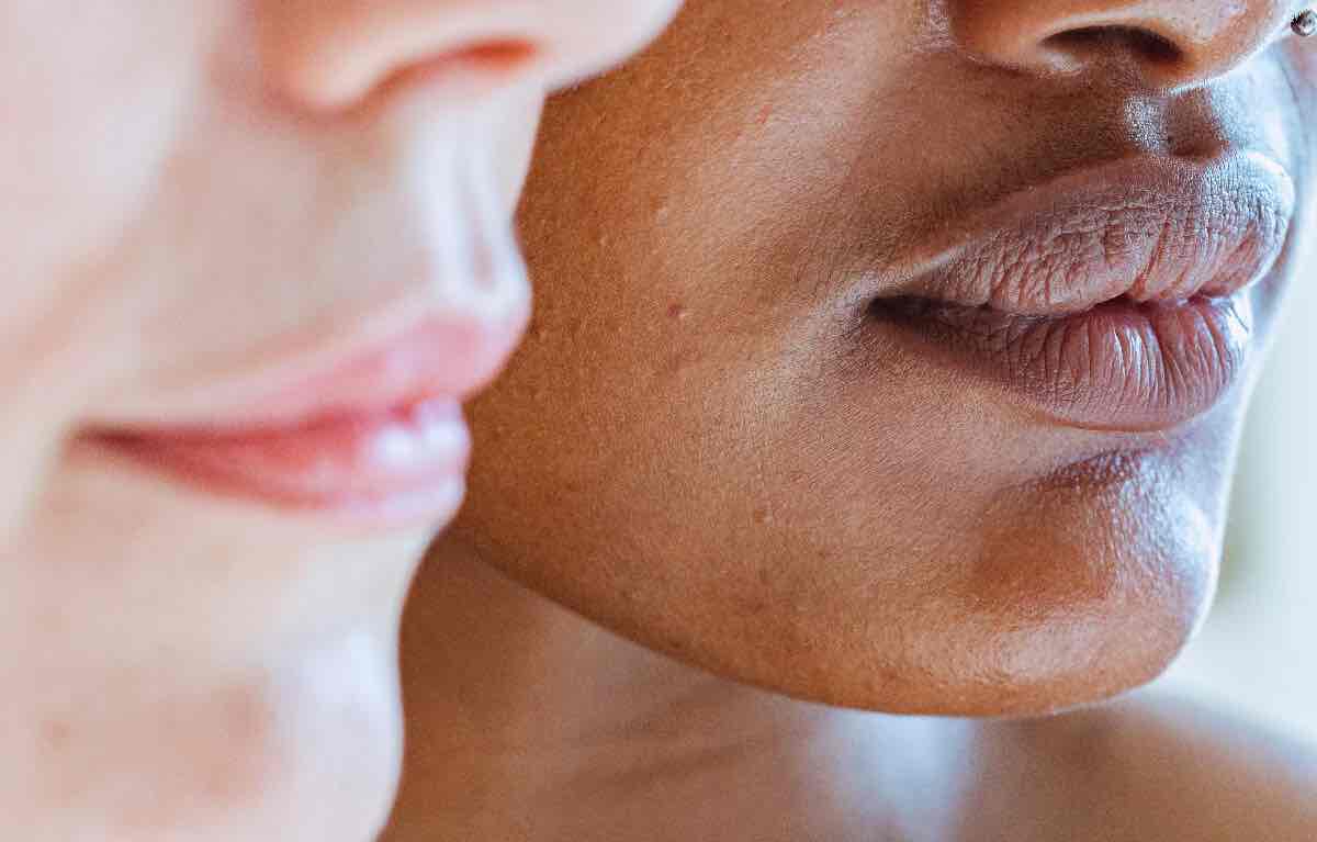 Breakout vs. Skin Purging: Expert Skin Advice from Online Skin Health ...