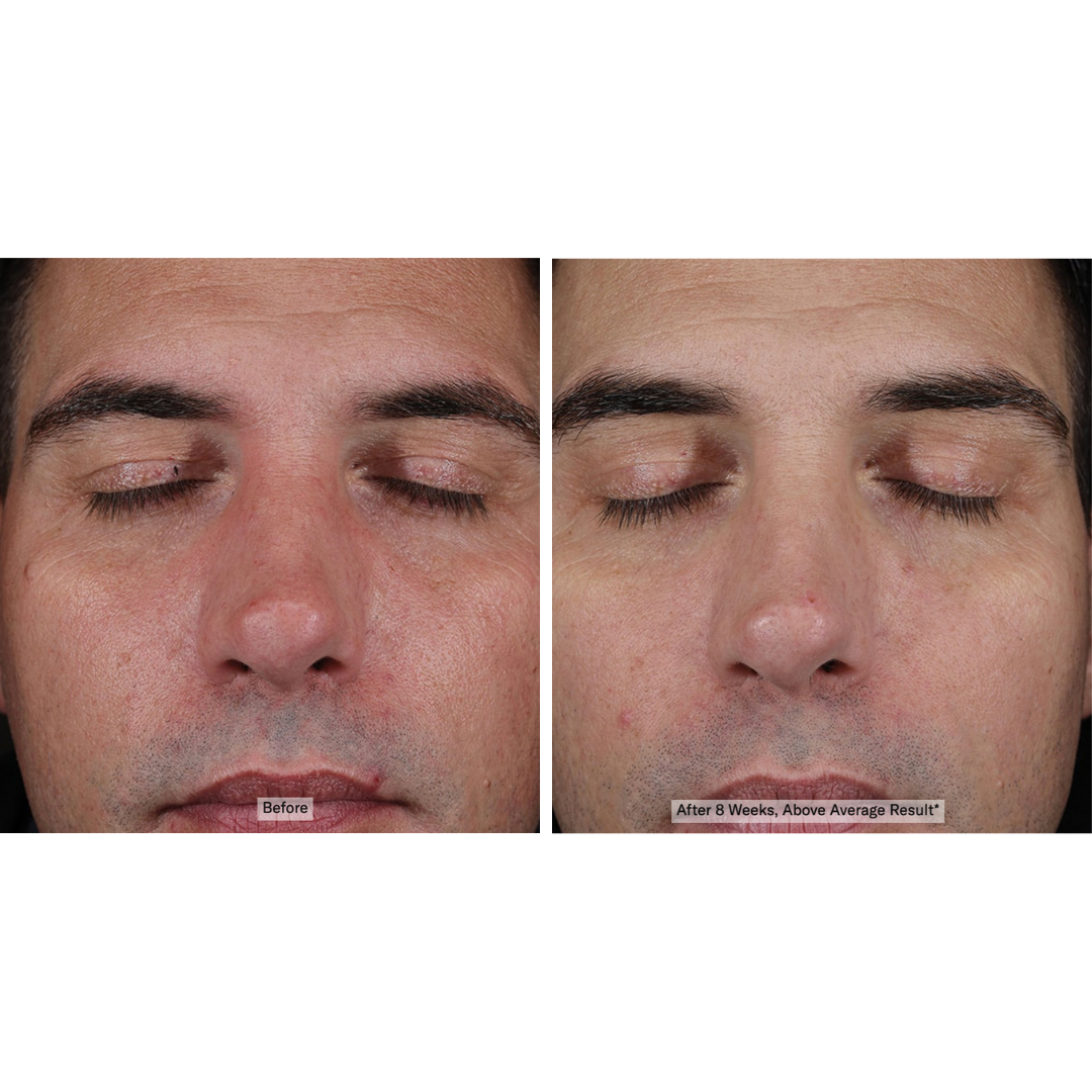 Mystro™ Active Balance Serum - SkinBetter Science